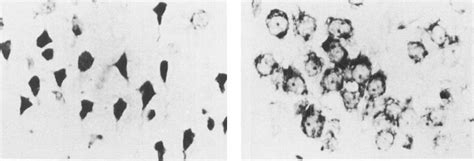 Photomicrographs Of The Pyriform Cortex From The Same Animals As Fig