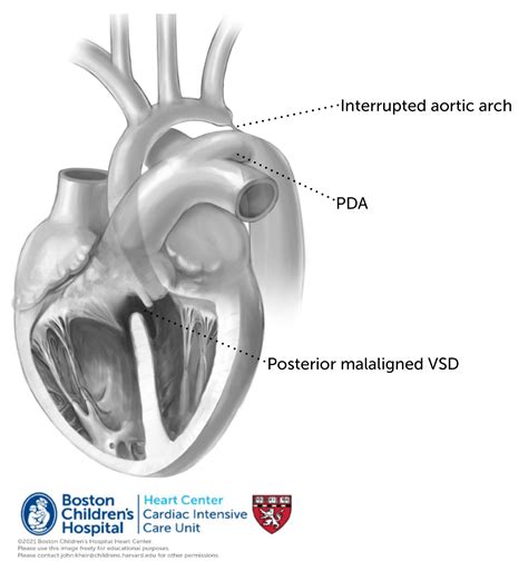 Vsd Iaa Online Supplement