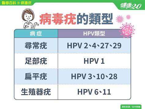 病毒疣／感染hpv形成皮膚病 赤腳、打麻將會傳染！病毒疣4類型 部位、症狀一次看