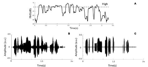 figure 1 from robust eeg based decoding of auditory attention with high