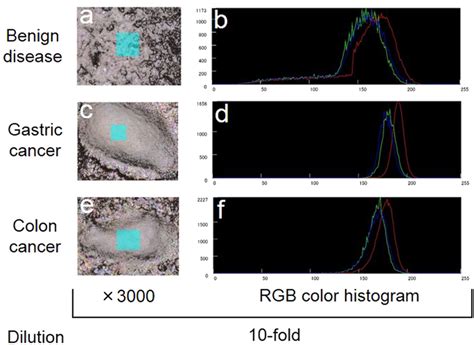 Rgb Color Histograms Of The Structure On The Surface Of Silver Nhc