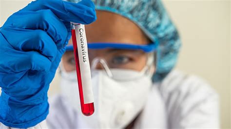 კორონავირუსის სტატისტიკა კვირაში ერთხელ გამოქვეყნდება Metronome Ge