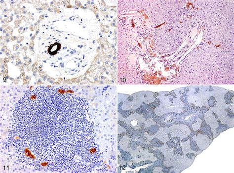 Histopathologic Features Immunophenotyping Clonality And Eubacterial Fluorescence In Situ