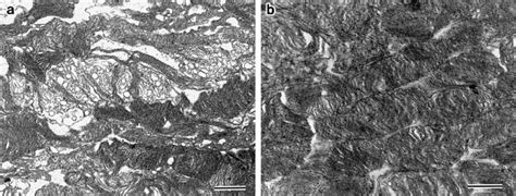 Electron Micrographs Of Photoreceptor Outer Segment Of Untreated A