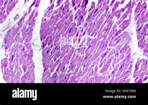 Heart Muscle Micrograph Stock Videos And Footage Hd And 4k Video Clips