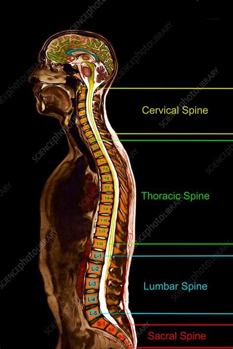 Cervical Spine Mri Labeled