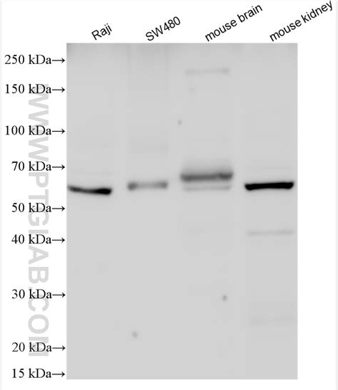 Slc1a4 Antibody 13067 2 Ap Proteintech