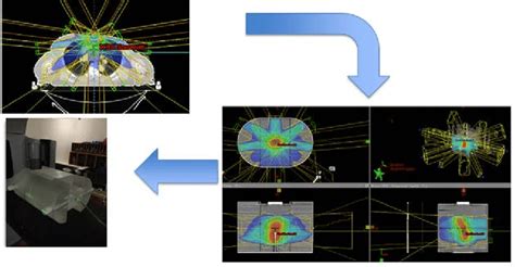 Workflow Of Patient Specific Qa Download Scientific Diagram