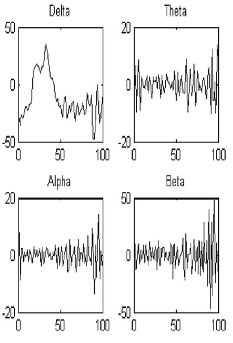 Decomposition Using Opa Into Four Rhythms Of The Eeg Signal Download