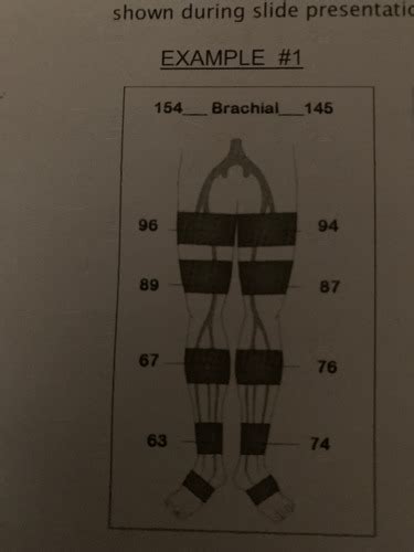 Doppler Segmental Pressure E 5 6 And 7 Flashcards Quizlet