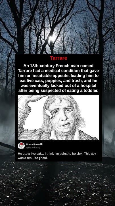 An 18th Century French Man Named Tarrare Had A Medical Condition That