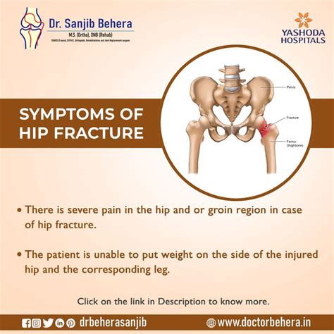 Hairline Fracture Hip Symptoms