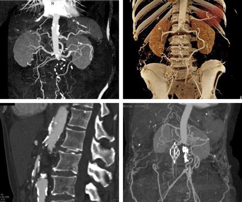 Ct Quick Guides Ct Scanning
