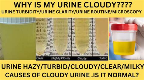 What Is Turbidity In Urine At Katie Bates Blog