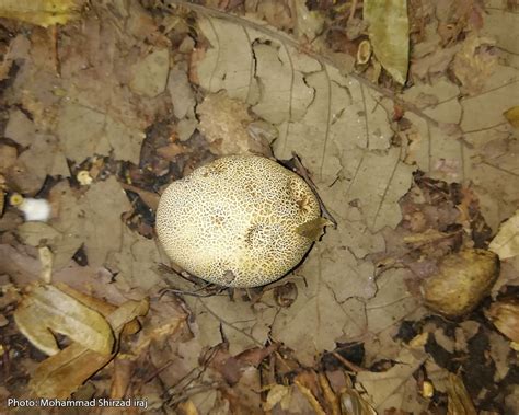 Scleroderma Areolatum Mohammad Shirzad Iraj