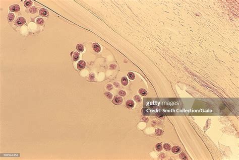 Under A Low Magnification Of Only 40x This Photomicrograph Revealed News Photo Getty Images