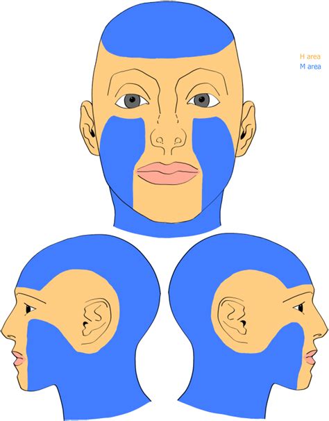 Expression Rates Of P16 P53 In Head And Neck Cutaneous Squamous Cell