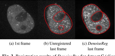 figure 1 from denoisereg unsupervised joint denoising and registration