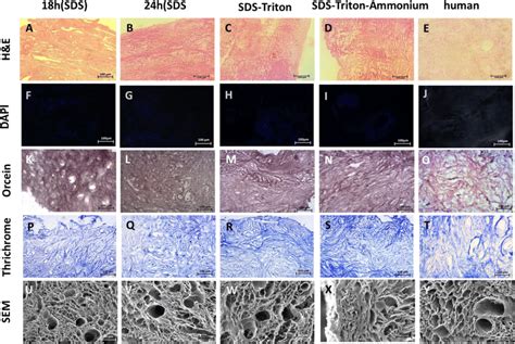 Extracellular Matrix Structure And Composition Preservation Download Scientific Diagram
