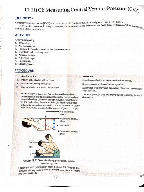 Cvp Monitoring Pdf