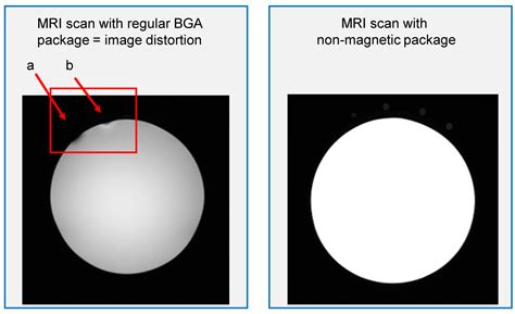 Tiny Quad Channel Bit MSPS ADC Targets Medical MRI Available Without Magnetic