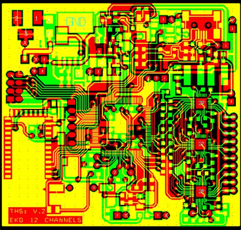 Ads1293 Data Converters Forum Data Converters Ti E2e Support Forums