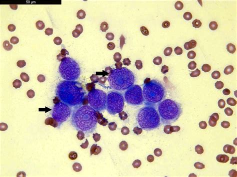 Serous Fluid Cytology Pathology Outlines