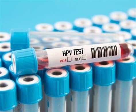 How To Use An Hpv Rapid Test
