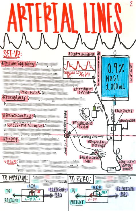 Arterial Line Set Up