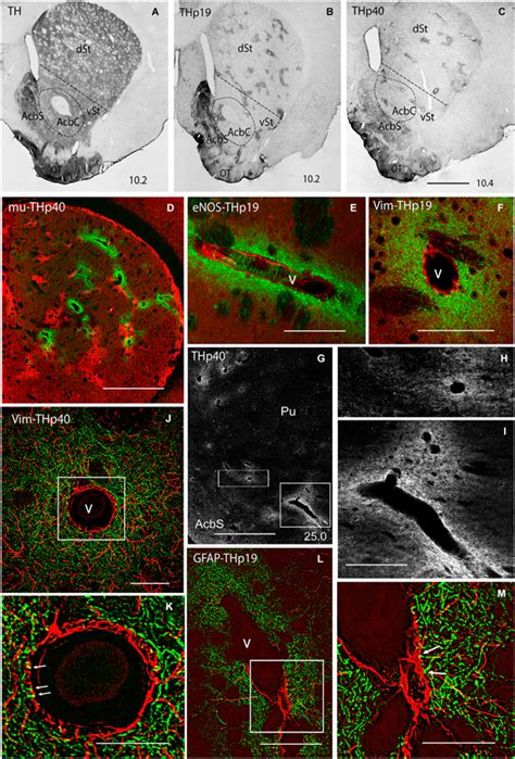 Tyrosine Hydroxylase Staining