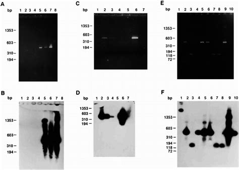 Pcr Detection Of Phytophthora Species From Infected Potato Leaf And Download Scientific Diagram