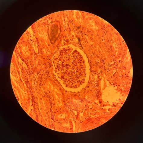 [mt636 Lab] Tissue Microscope Slides Flashcards Quizlet
