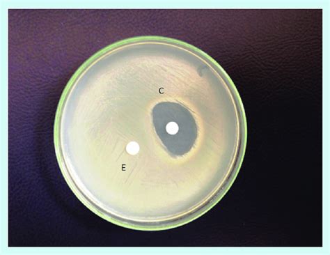 Photograph Of Inducible Clindamycin Resistant D Test Positive Showing