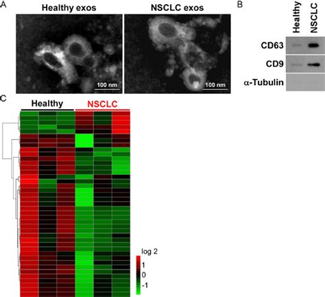 Screening And Quantification Of Differential Exosomal Lncrnas In The Download Scientific