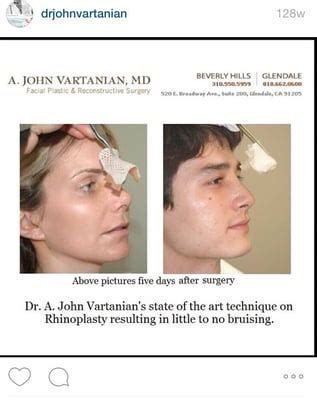 John A Vartanian Md Facs Updated April 2026 396 Photos And 206