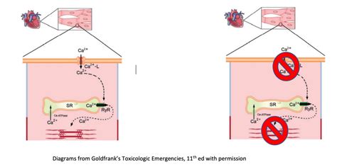 Updates In High Dose Insulin And Euglycemia Therapy Hiet For The