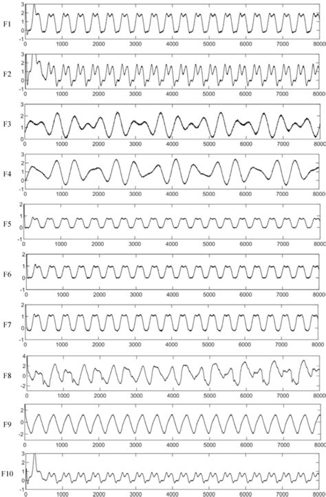Figure 12 From Sensor And Actuator Fault Diagnosis For Robot Joint