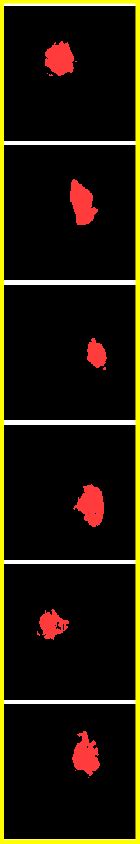 Visualization Results On Brats Dataset Of Different Methods First Six