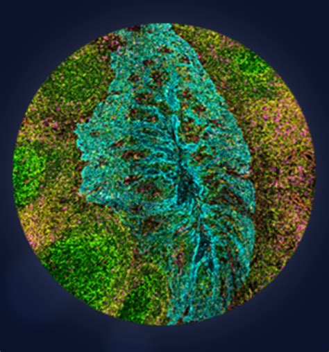 Ihisto Lymphocyte Profiling Module
