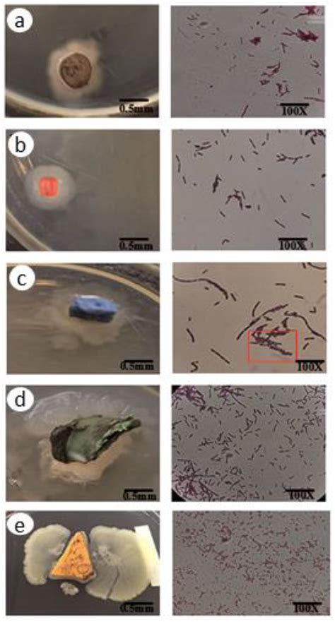 Characterization Of Microplastics And Mesoplastics And Presence Of