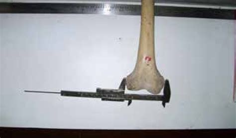 Table 1 From Maximum Femoral Length And Bicondylar Width As A Tool For Sexual Dimorphism