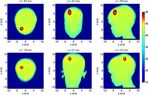 Steady State Temperature Distributions Through The Maximum Temperature Download Scientific