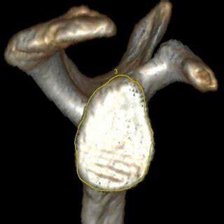 Demonstration Of Measurement Of The Perimeter Download Scientific Diagram