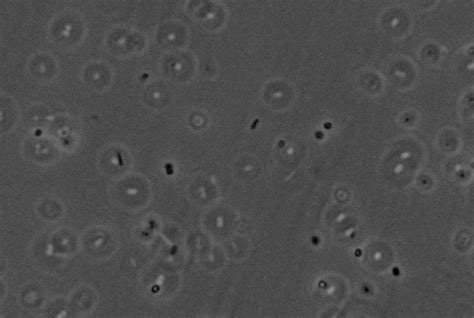 detection bacter 8 micron object detection dataset by maxim