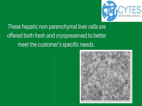 Human Hepatic Stellate Cells Ppt