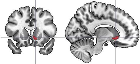 Parametric Modulation Of The Brain Activation During Long Term Memory