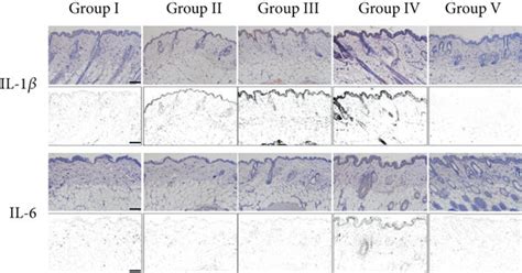 Ihc Analysis Of Inflammatory Cytokine Il 1β Il 6 Group I Control