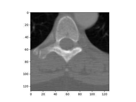 Read A Dataset And Plot Pixel Data — Pydicom 3 1 0 Dev0 Documentation