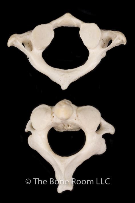 Human Atlas And Axis Vertebrae Set