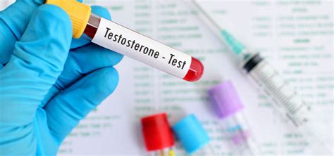 How To Test Testosterone Levels Methods And Insights